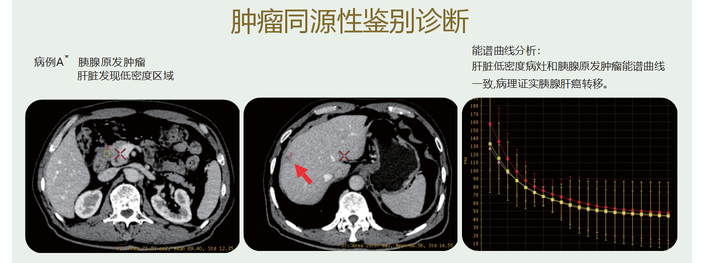 GE Revolution CT - 设备展示 - 贵黔国际医院